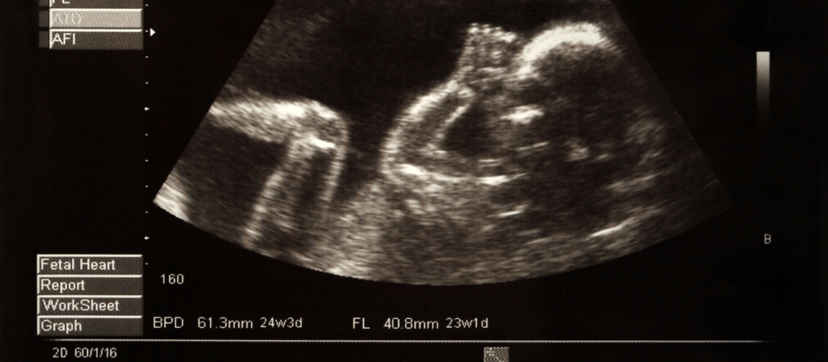 Act Now: Protect the Unborn in Pennsylvania! – Concerned Women for America